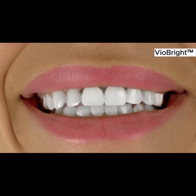 VioBright™ Whitening Strips – Flenoro